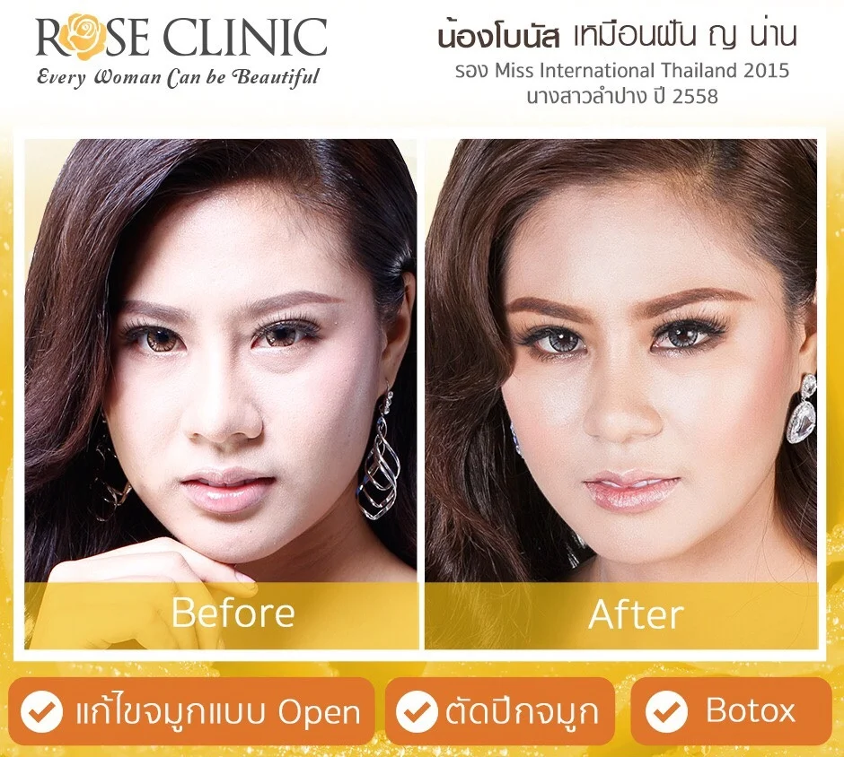 Rose Clinic ความสวยสร้างได้ด้วยฝีมือจากแพทย์ผู้เชี่ยวชาญ